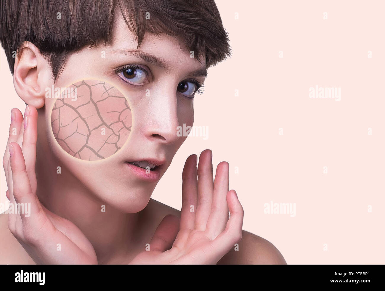 Woman face covered with cracked earth texture- symbol of dry skin Stock ...