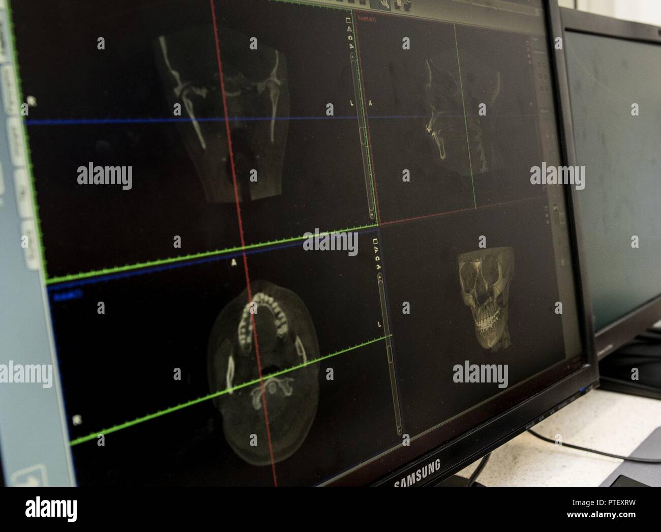 Cone beam scan hi-res stock photography and images - Alamy
