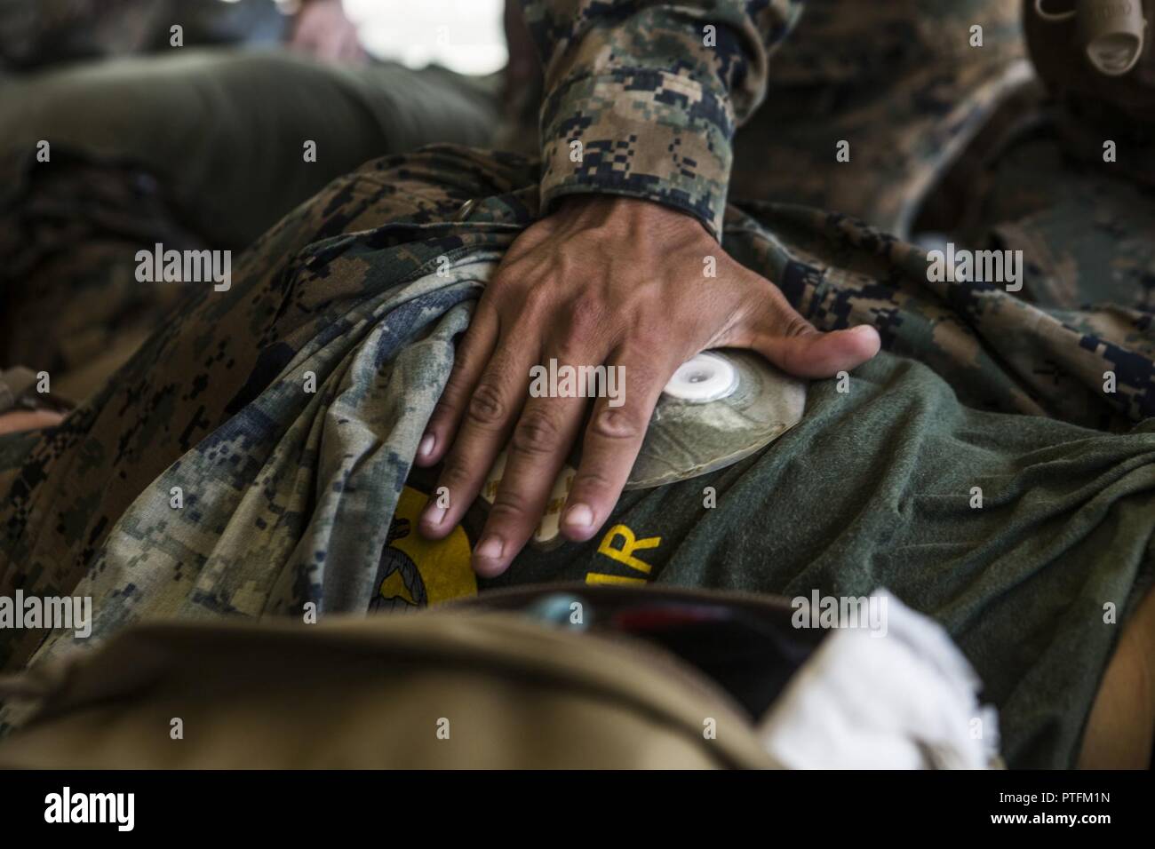 Sucking chest wound hi-res stock photography and images - Alamy