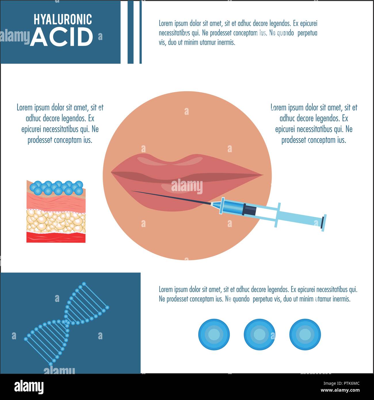 hyaluronic acid filler injection infographic Stock Vector Image & Art ...