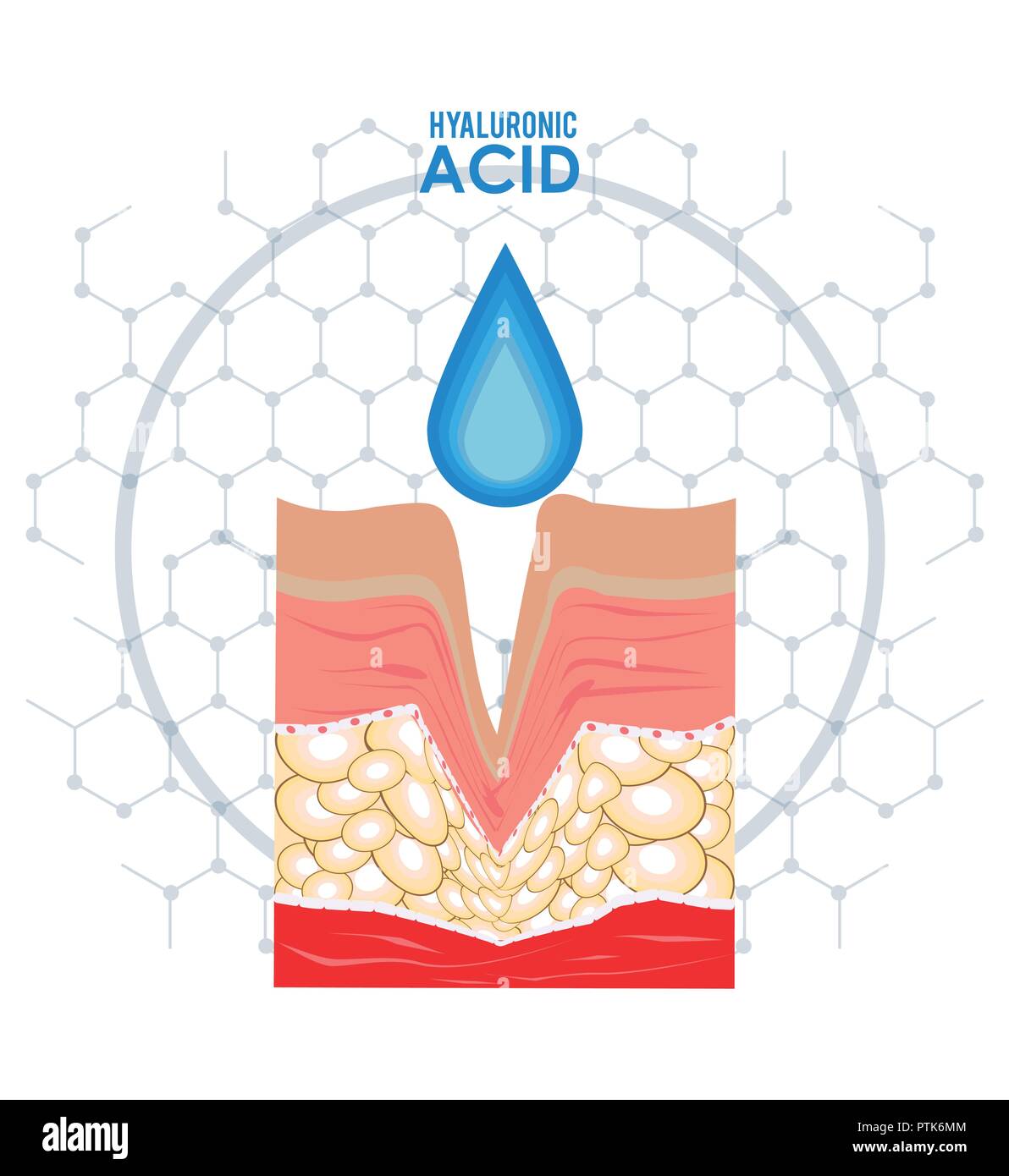 hyaluronic acid filler injection infographic Stock Vector Image & Art ...