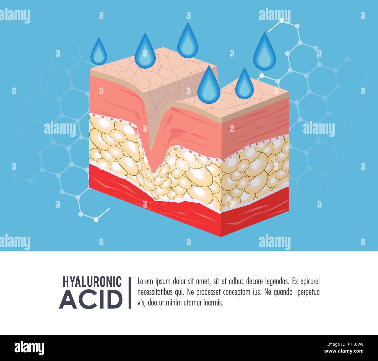 hyaluronic acid filler injection infographic Stock Vector Image & Art ...