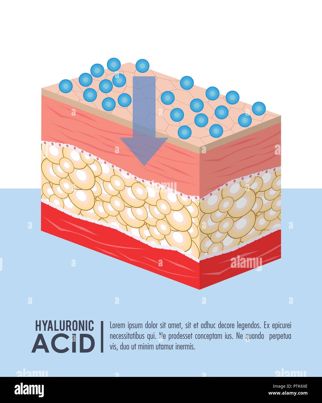 hyaluronic acid filler injection infographic Stock Vector Image & Art ...