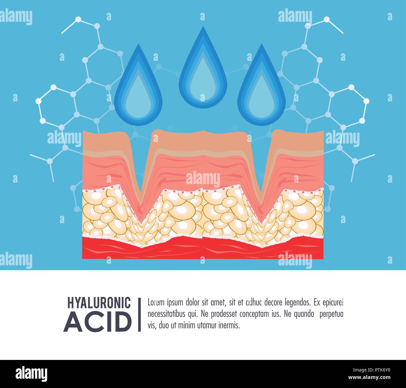 hyaluronic acid filler injection infographic Stock Vector Image & Art ...