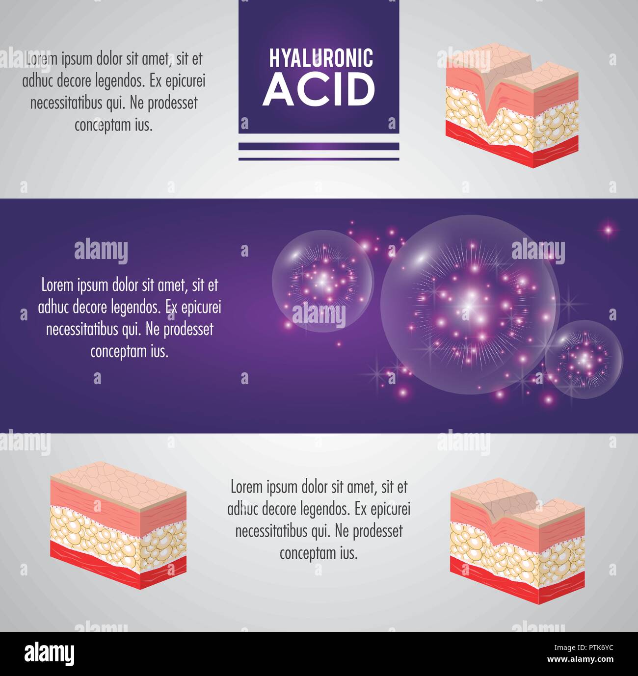 hyaluronic acid filler injection infographic Stock Vector Image & Art ...