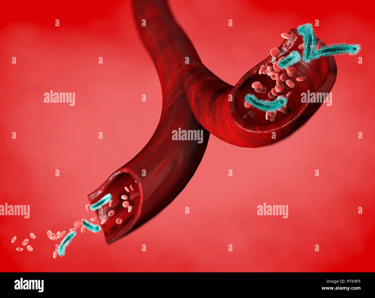 Vein and red blood cells attacked by a virus, circulation of bacteria ...