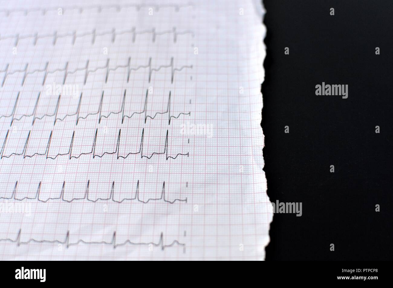 Electrocardiogram ekg hi-res stock photography and images - Alamy