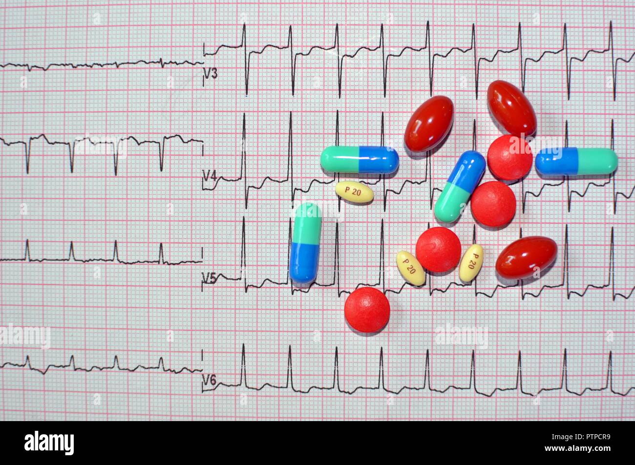 Ekg and pills Stock Photo - Alamy