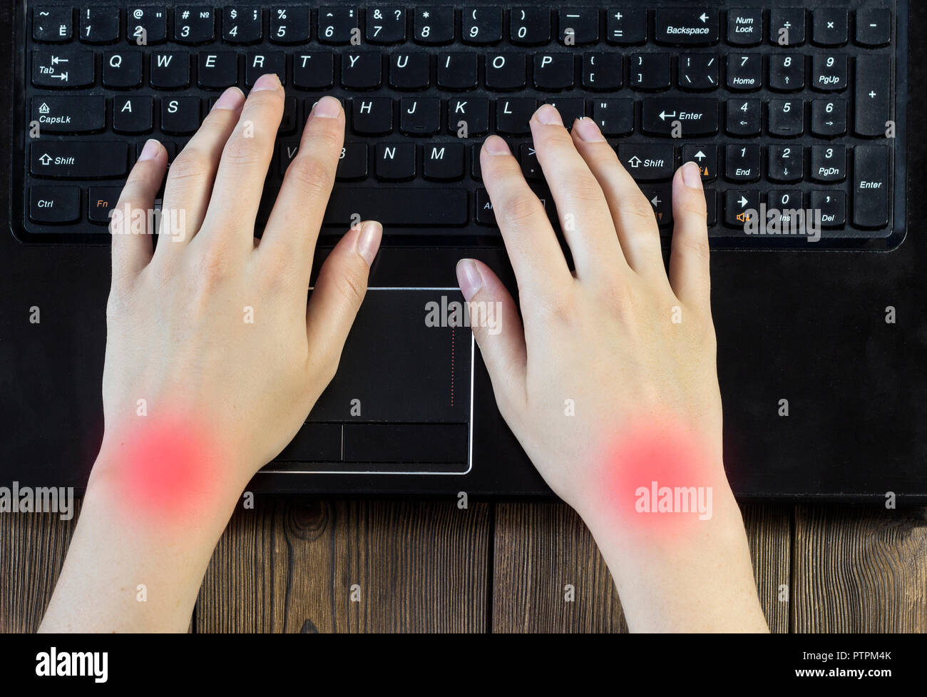 Female hands, joint pain work at a computer, close-up, tunnel syndrome ...