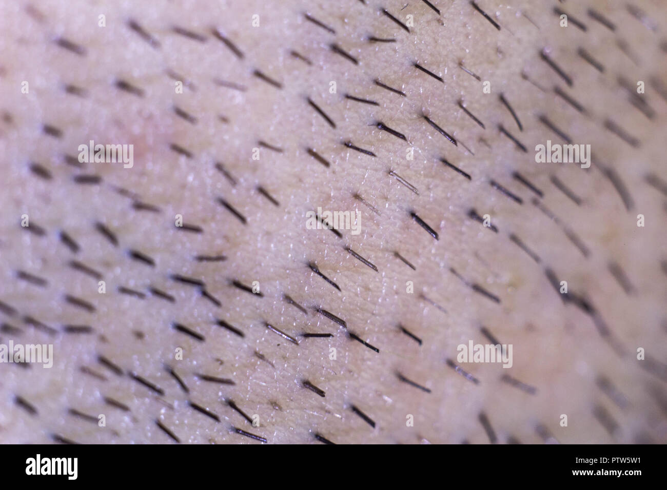 Sparse black bristles hi-res stock photography and images - Alamy