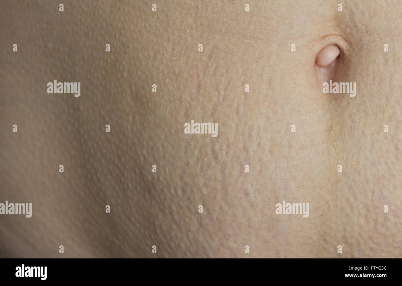 Female abdomen, stretching on stomach, close-up Stock Photo - Alamy