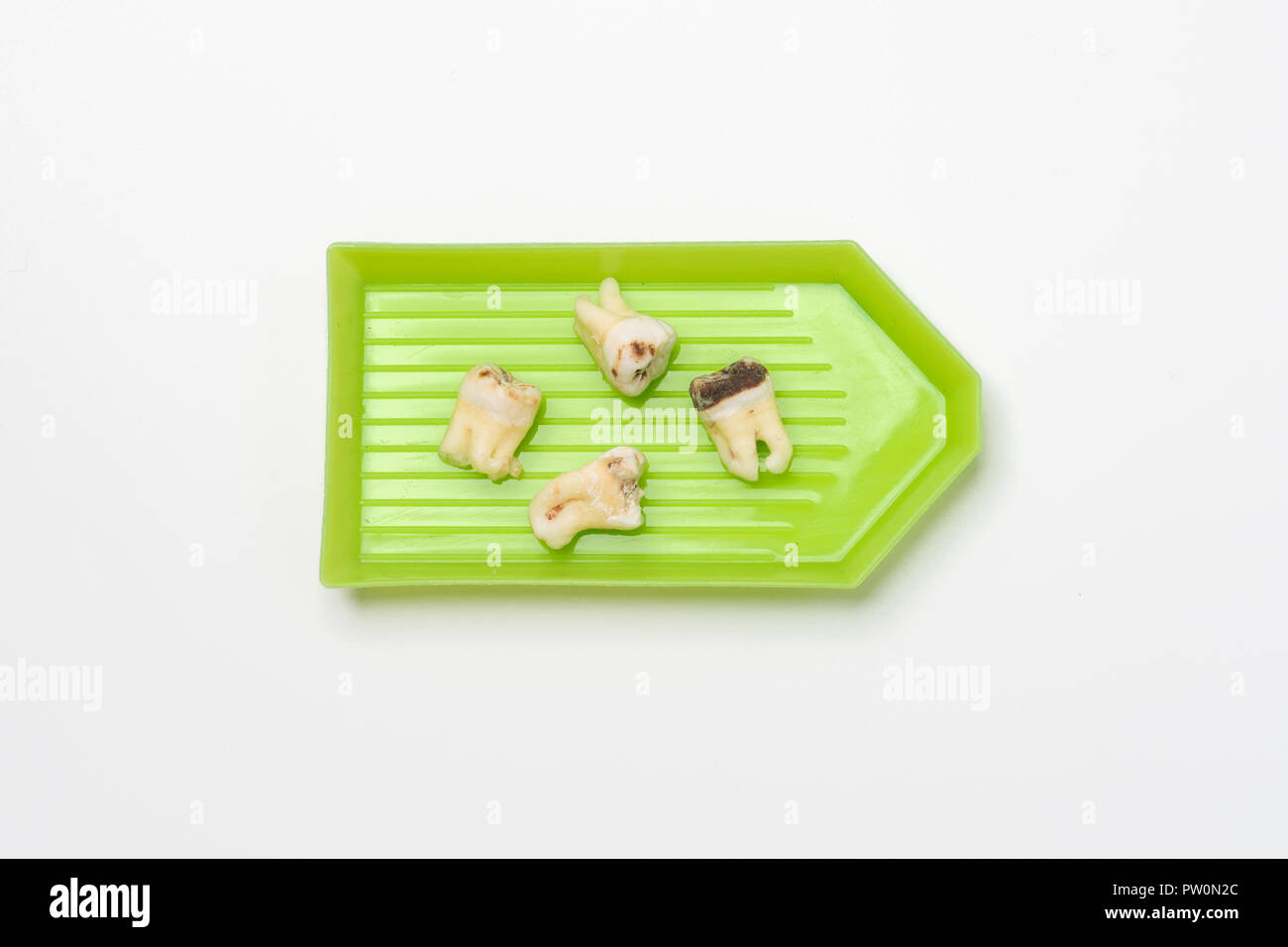 pulled out bad molars human teeth close up on white background Stock ...