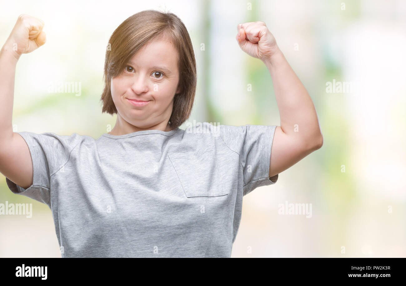Young adult woman with down syndrome over isolated background showing ...