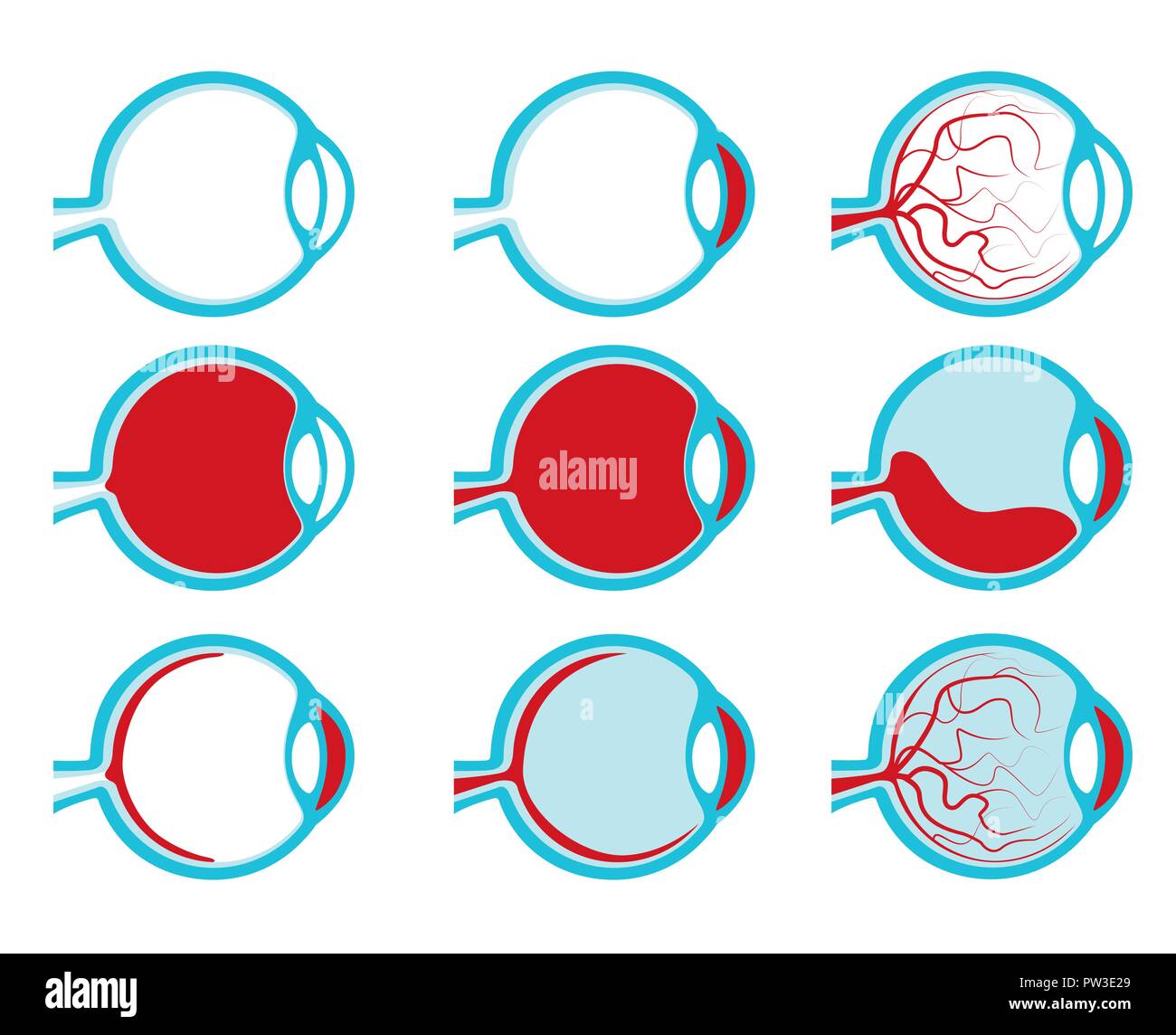 healthy and unhealthy human eyes side view Stock Vector Image & Art - Alamy