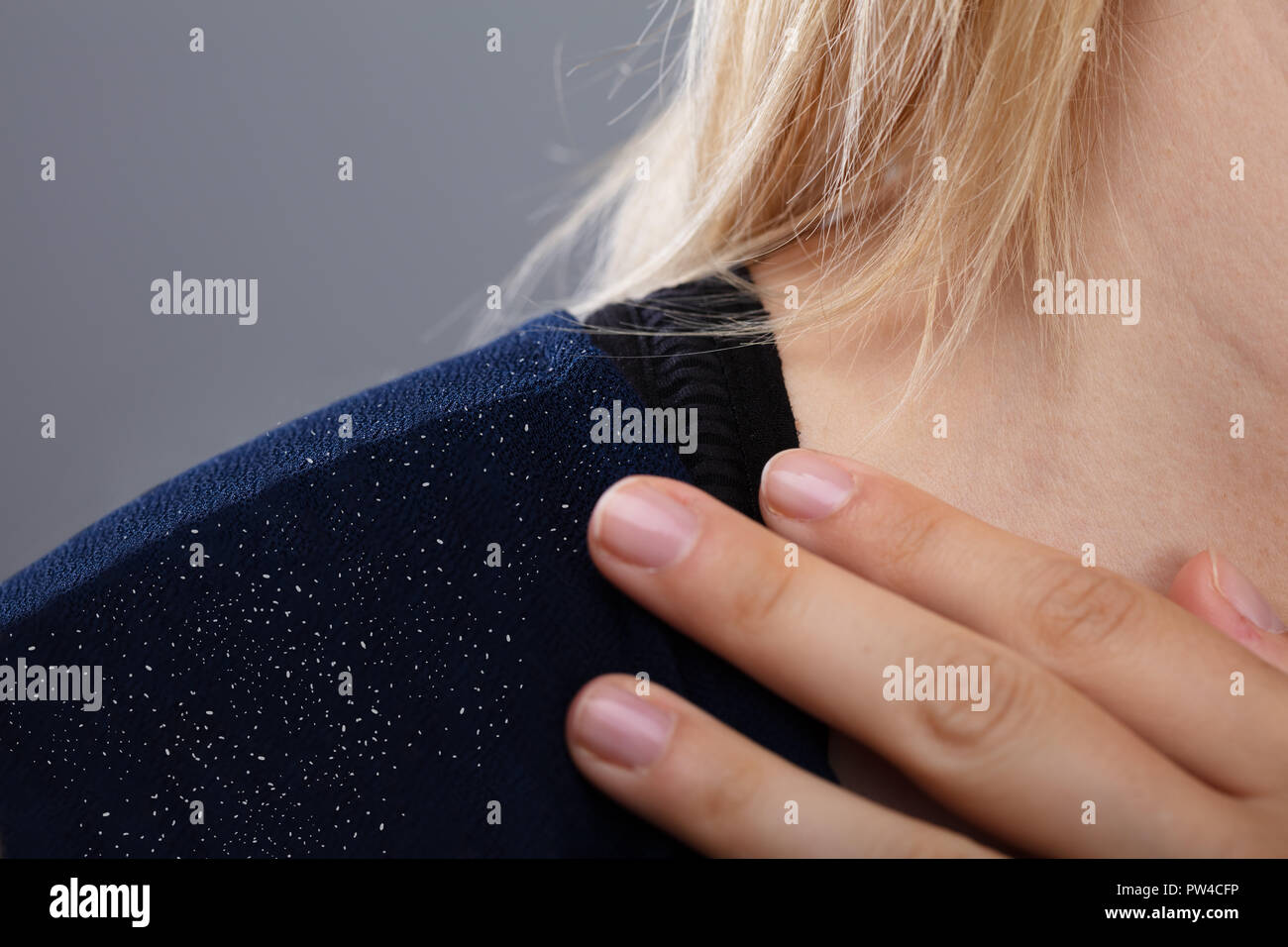 Woman dandruff shampoo hi-res stock photography and images - Alamy