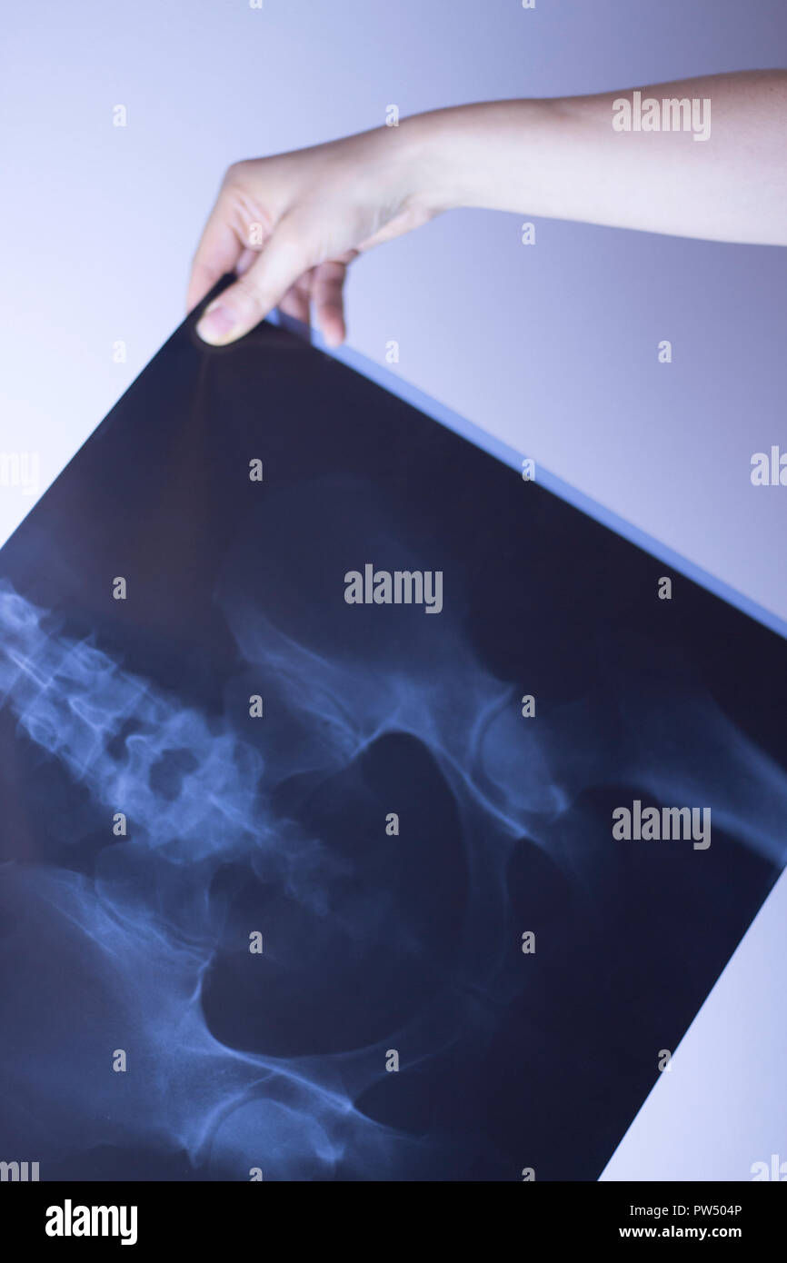 Medical hospital x-ray lowe back pain spine and hips traumatology scan ...