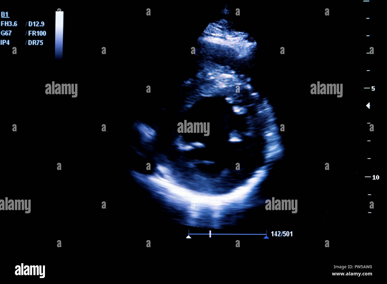 Colourful image of modern ultrasound monitor. Ultrasonography machine ...