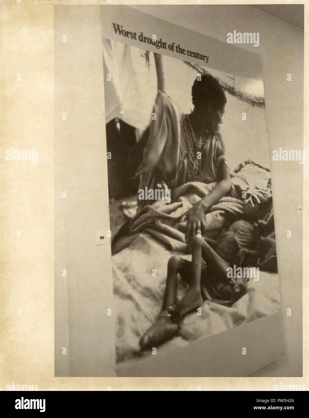 Snapshot of an emaciated patient, laying in a hospital bed Stock Photo ...
