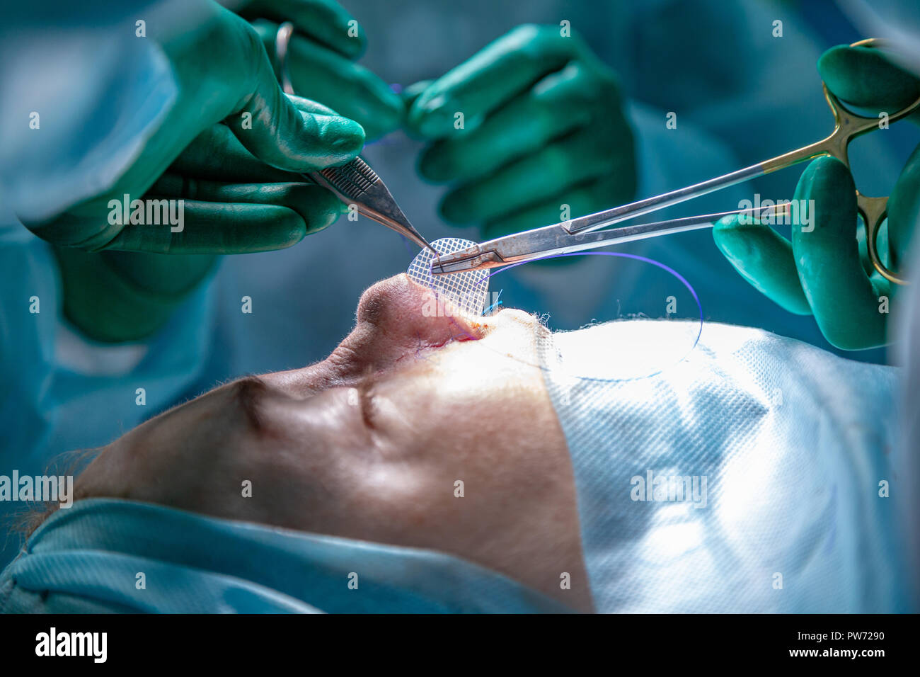 Surgeon and his assistant performing cosmetic surgery on nose in ...