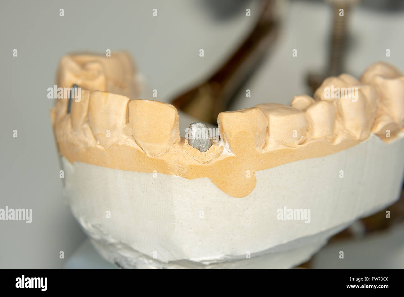 close-up human tooth together with a pin, is prepared by a bur under ...