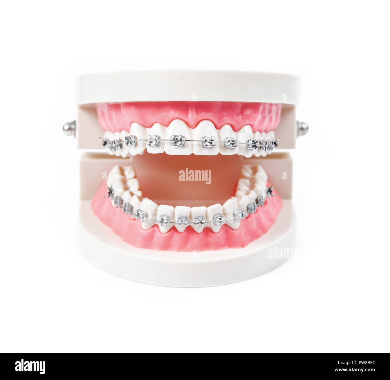 tooth model with metal wire dental braces isolated on white background ...