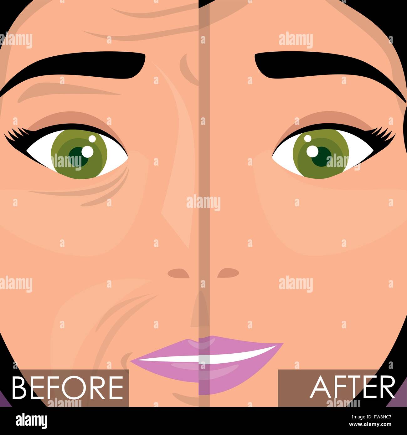 woman before and after skin treatment Stock Vector Image & Art - Alamy