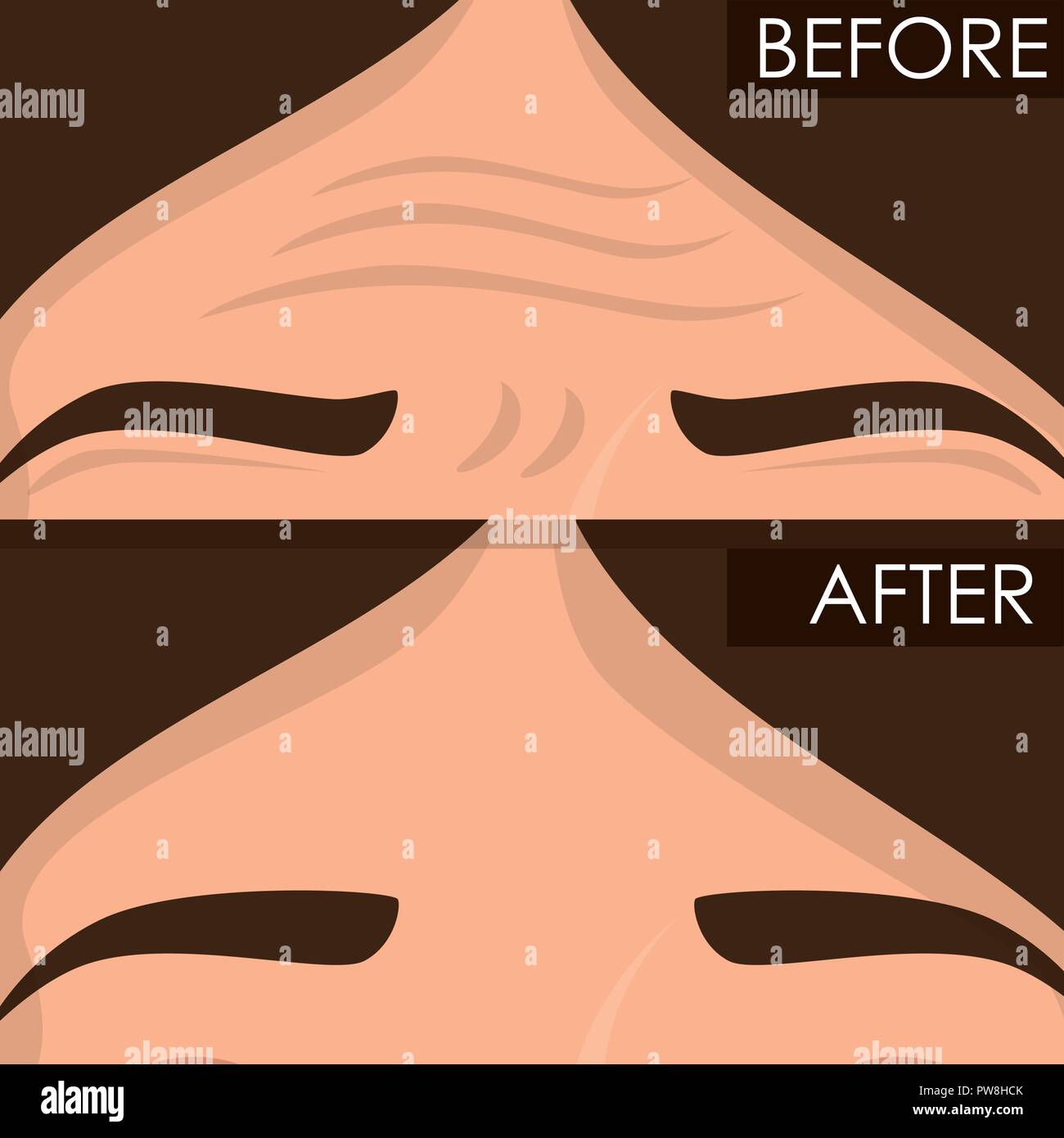 woman before and after skin treatment Stock Vector Image & Art - Alamy