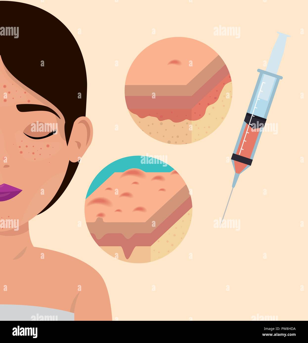 woman with botox treatment Stock Vector Image & Art - Alamy