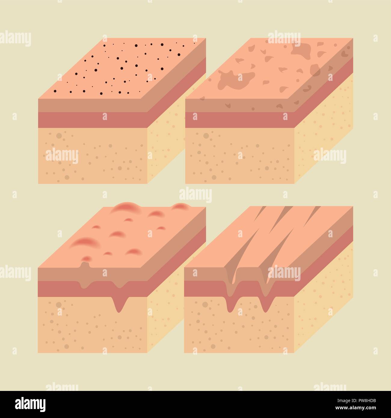 Human Skin Diagram High Resolution Stock Photography and Images - Alamy