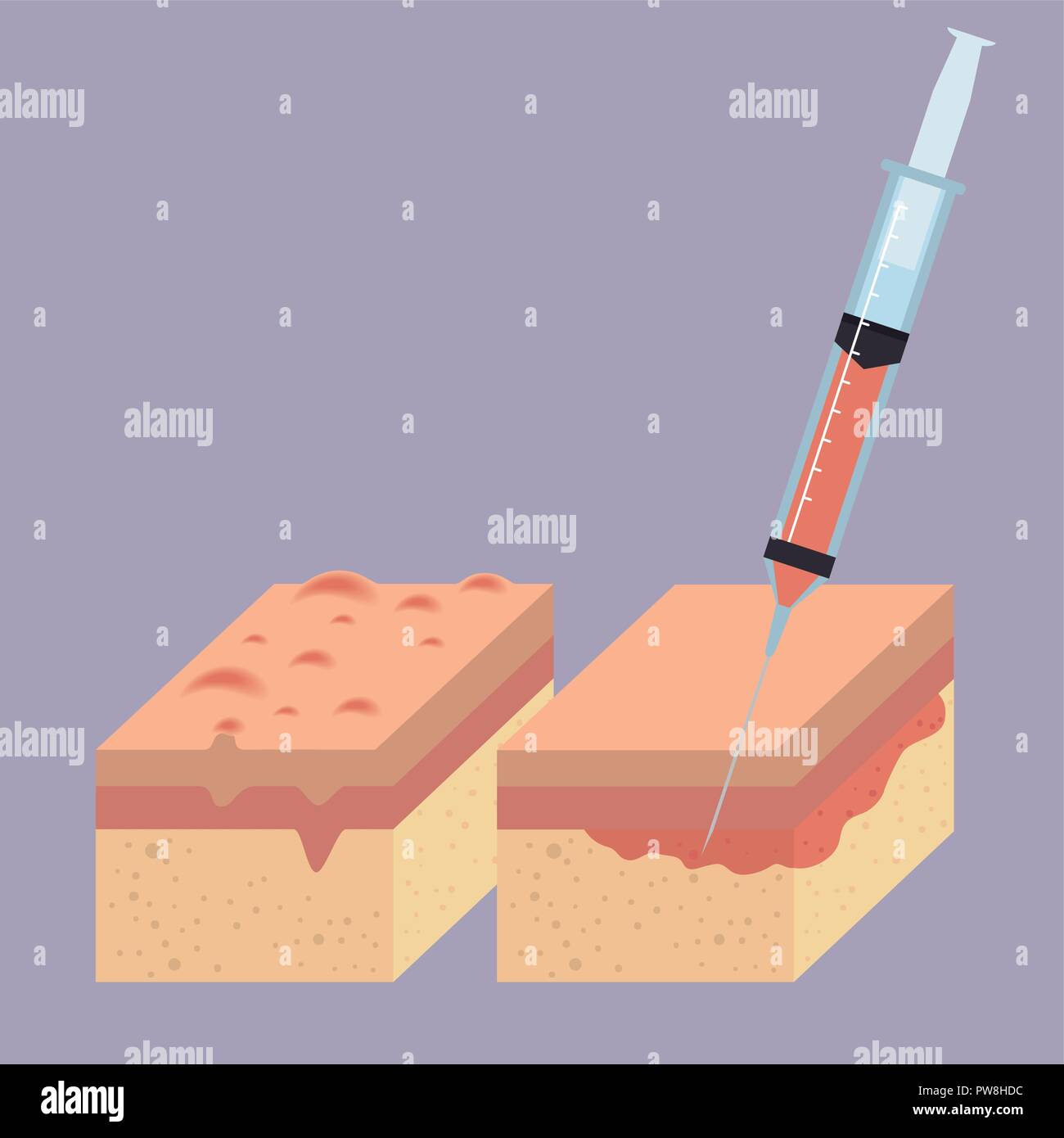 layers of skin with botox injection Stock Vector Image & Art - Alamy