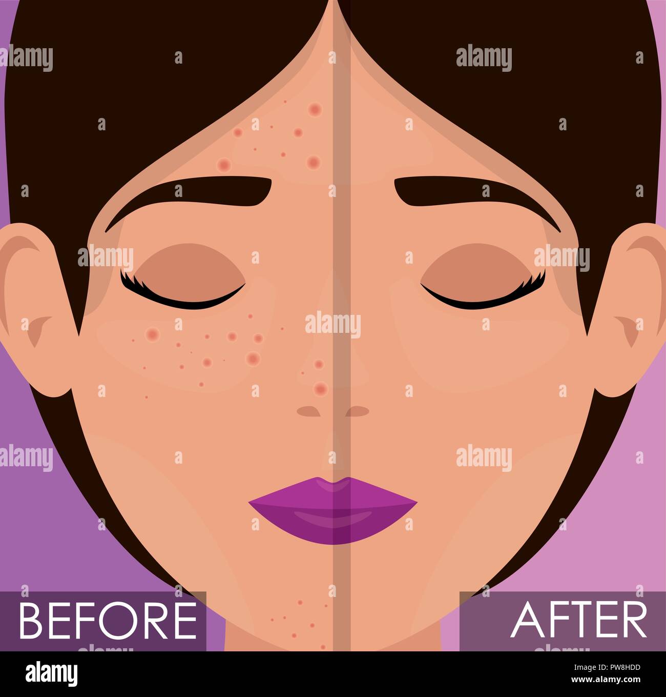 Woman before after face lift Stock Vector Images - Alamy