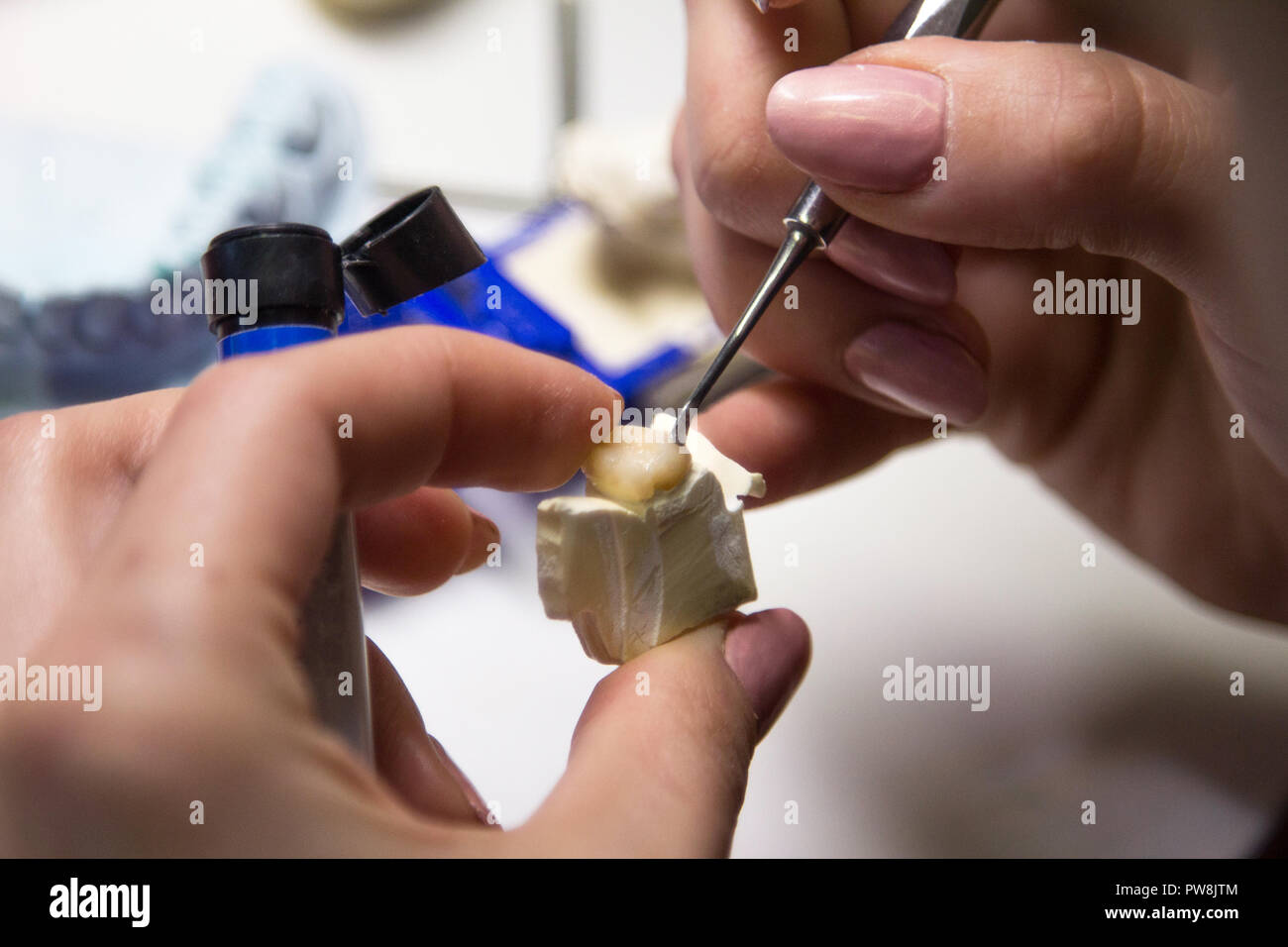 Dental prosthesis, artificial tooth, prosthetic, hands working on the ...