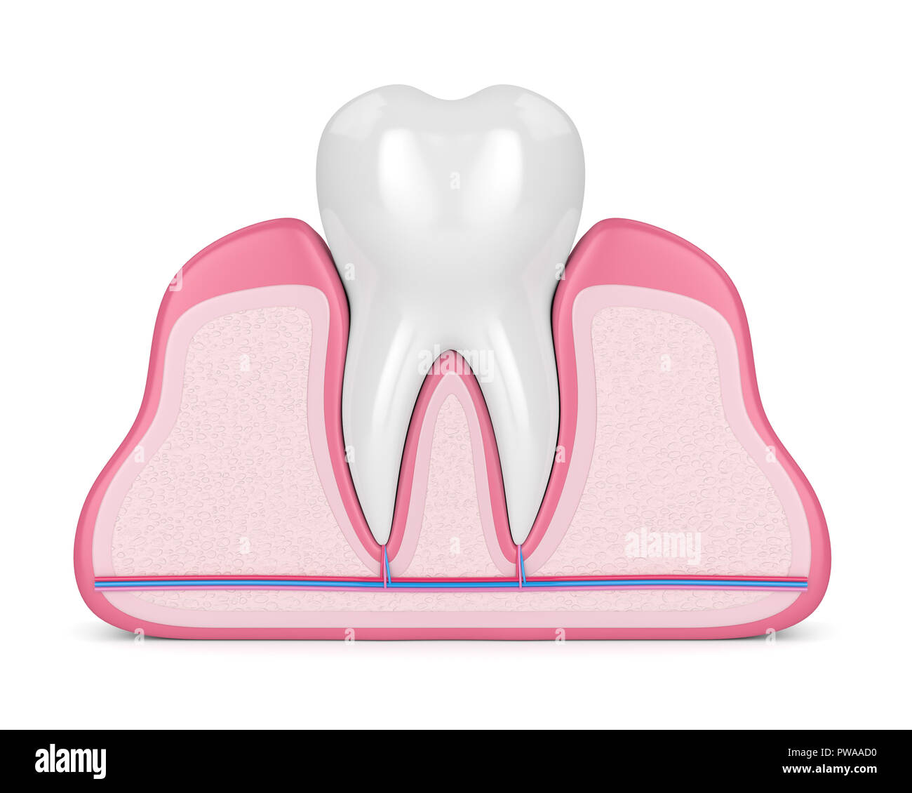 3d render of tooth in gums with nerves and blood vessels over white ...