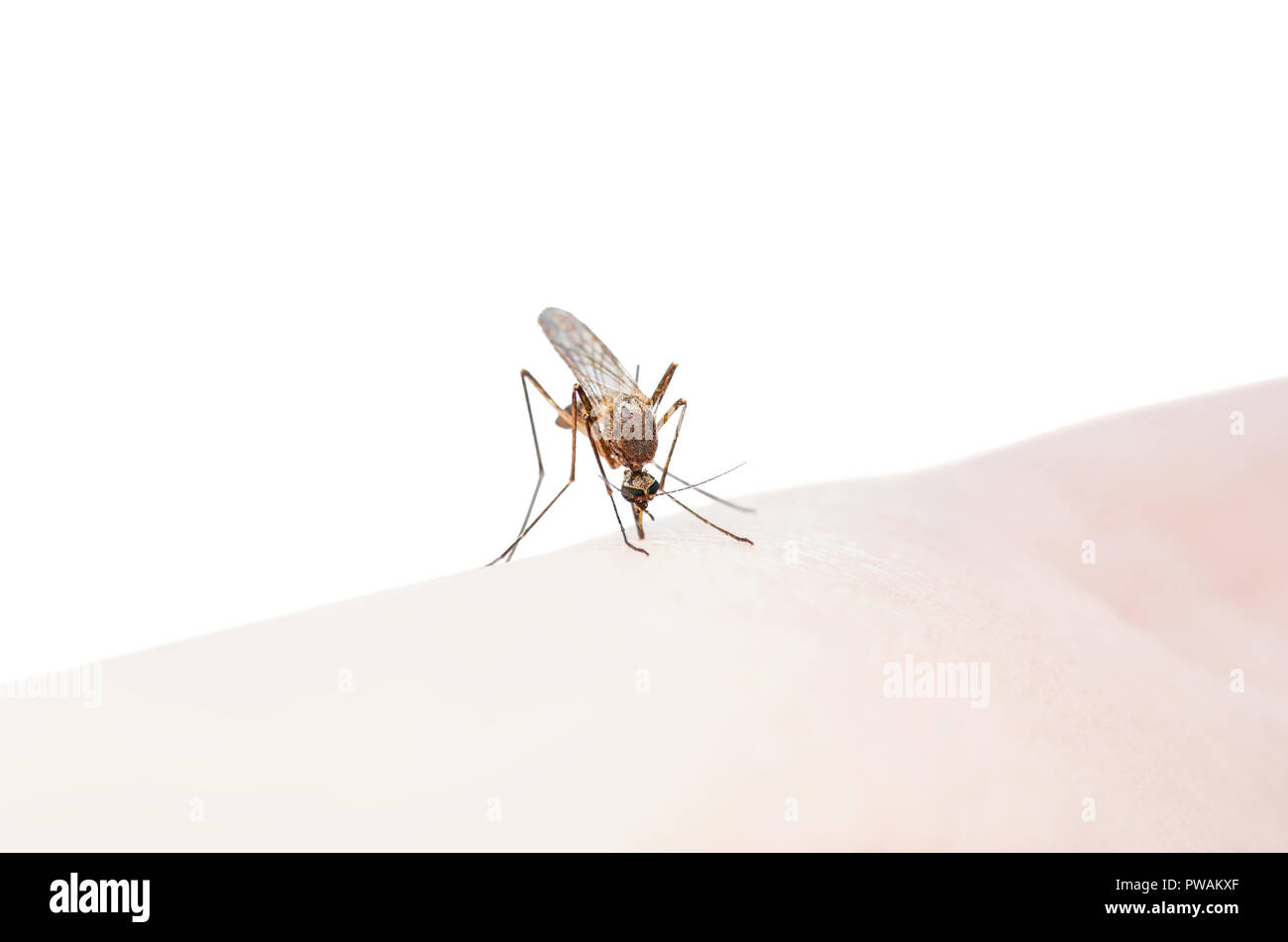 Infected insect bite hi-res stock photography and images - Alamy