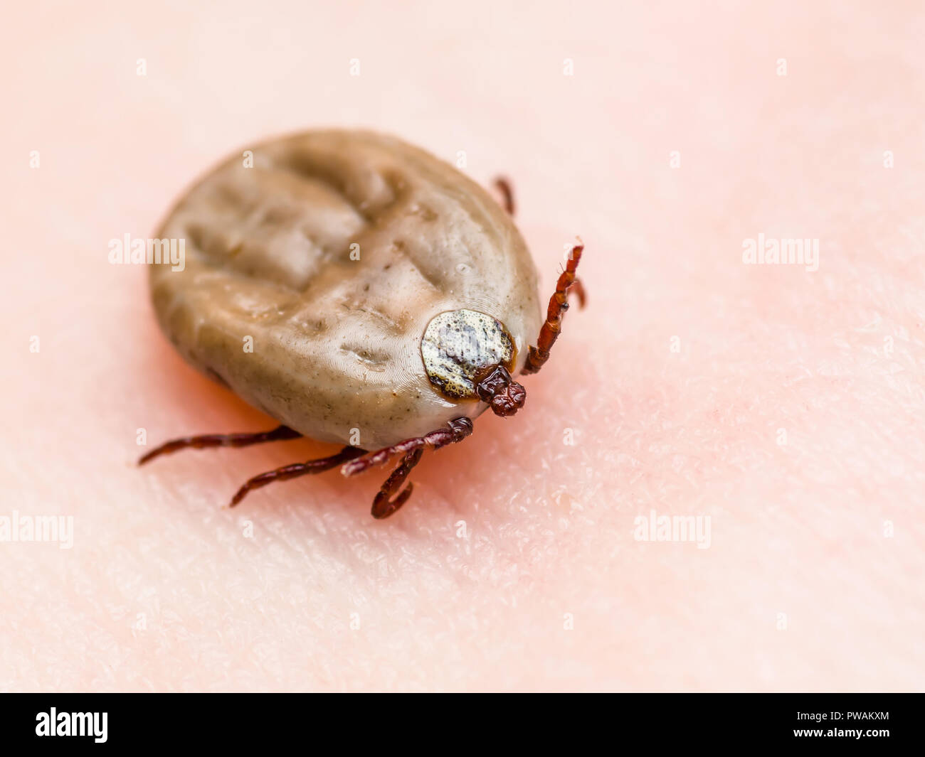 Encephalitis Virus or Lyme Disease or Monkey Fever Infected Tick ...