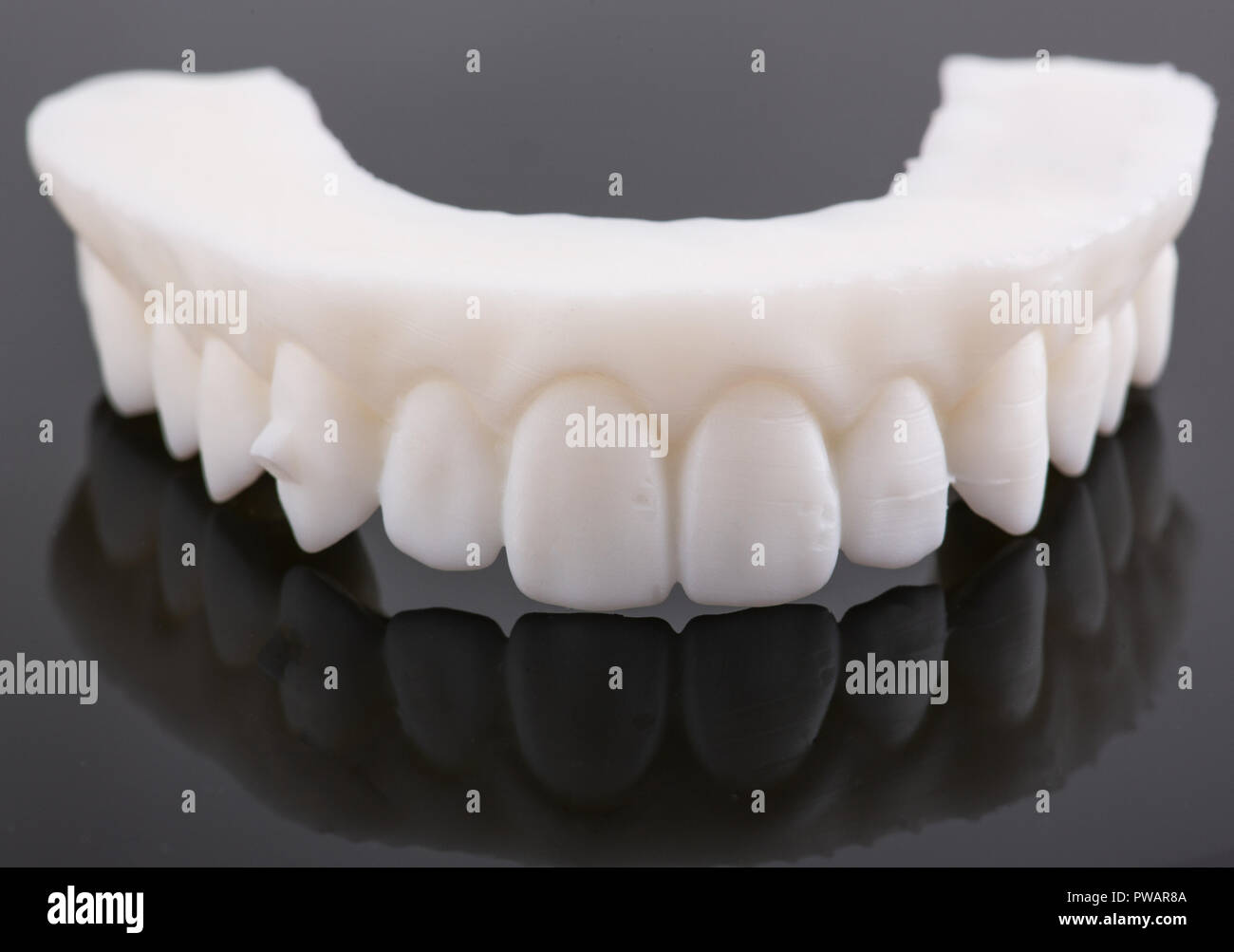Wax pattern teeth dental crowns on model, metal free - front view ...