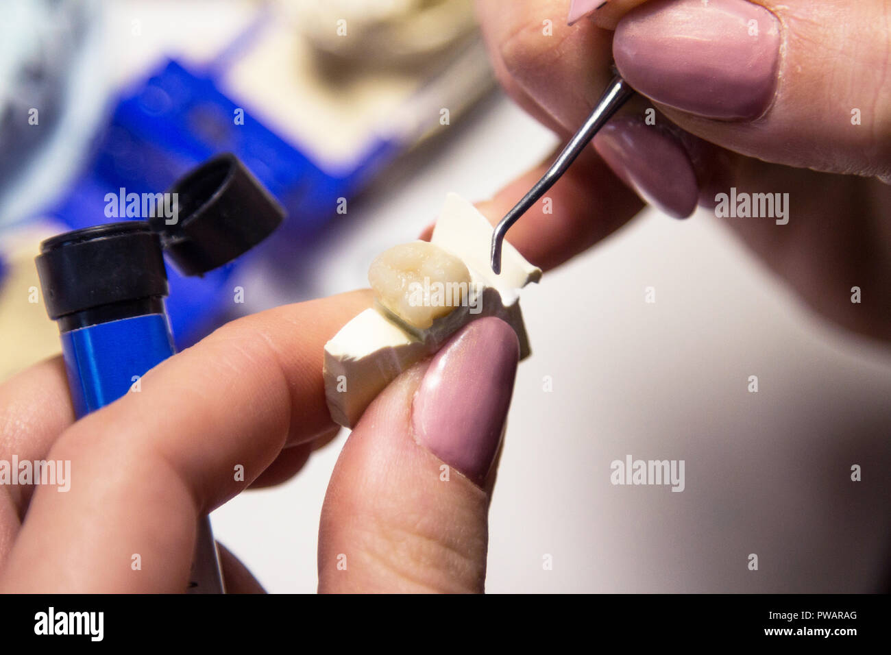 Dental prosthesis, artificial tooth, prosthetic, hands working on the ...