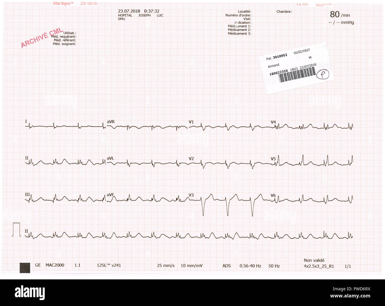 Electrocardiograme hi-res stock photography and images - Alamy