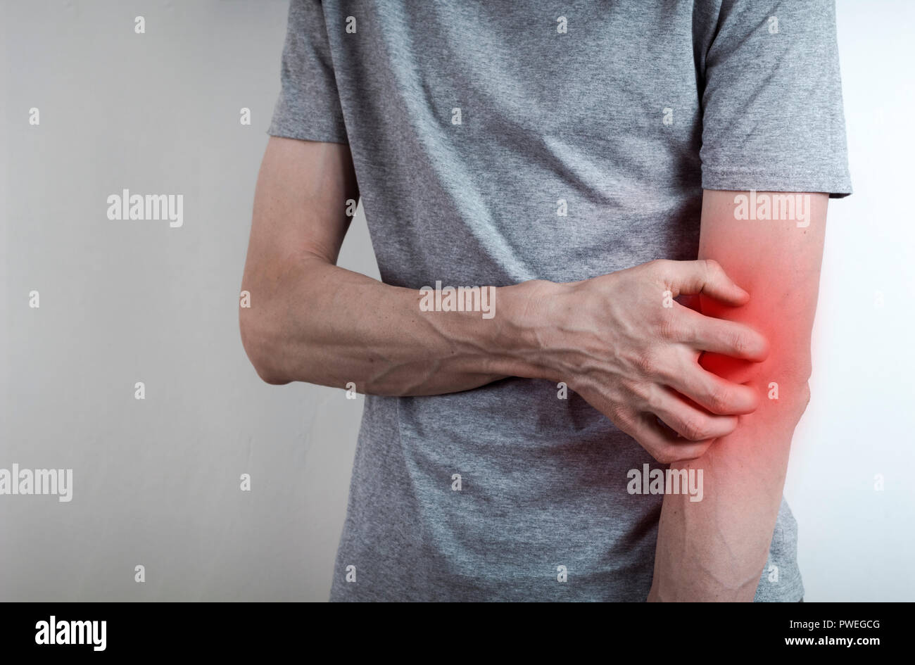 The concept of scabies. The man scratches his arm. Irritation. Drying ...