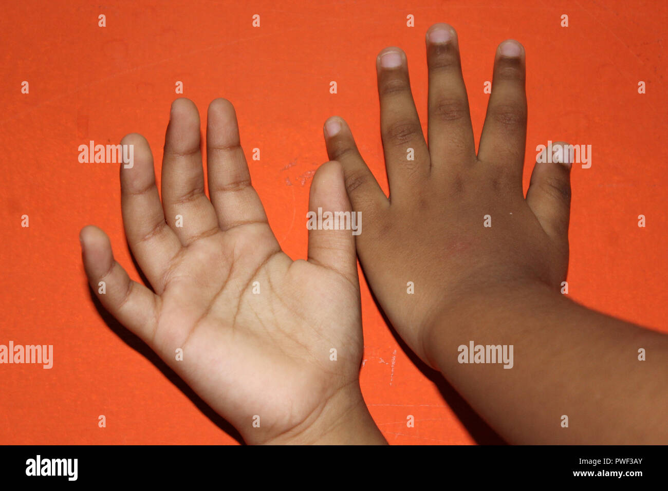 infant hand front and back Stock Photo - Alamy