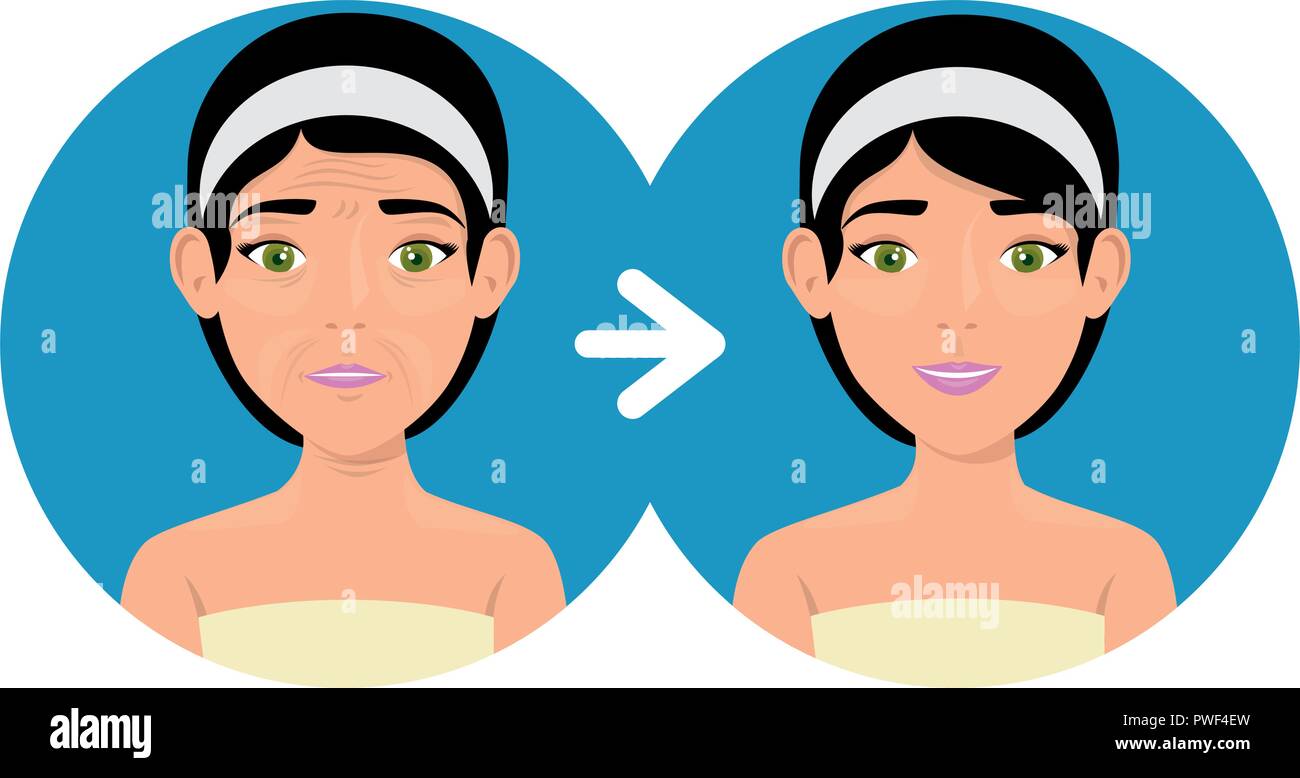 woman before and after skin treatment vector illustration design Stock ...