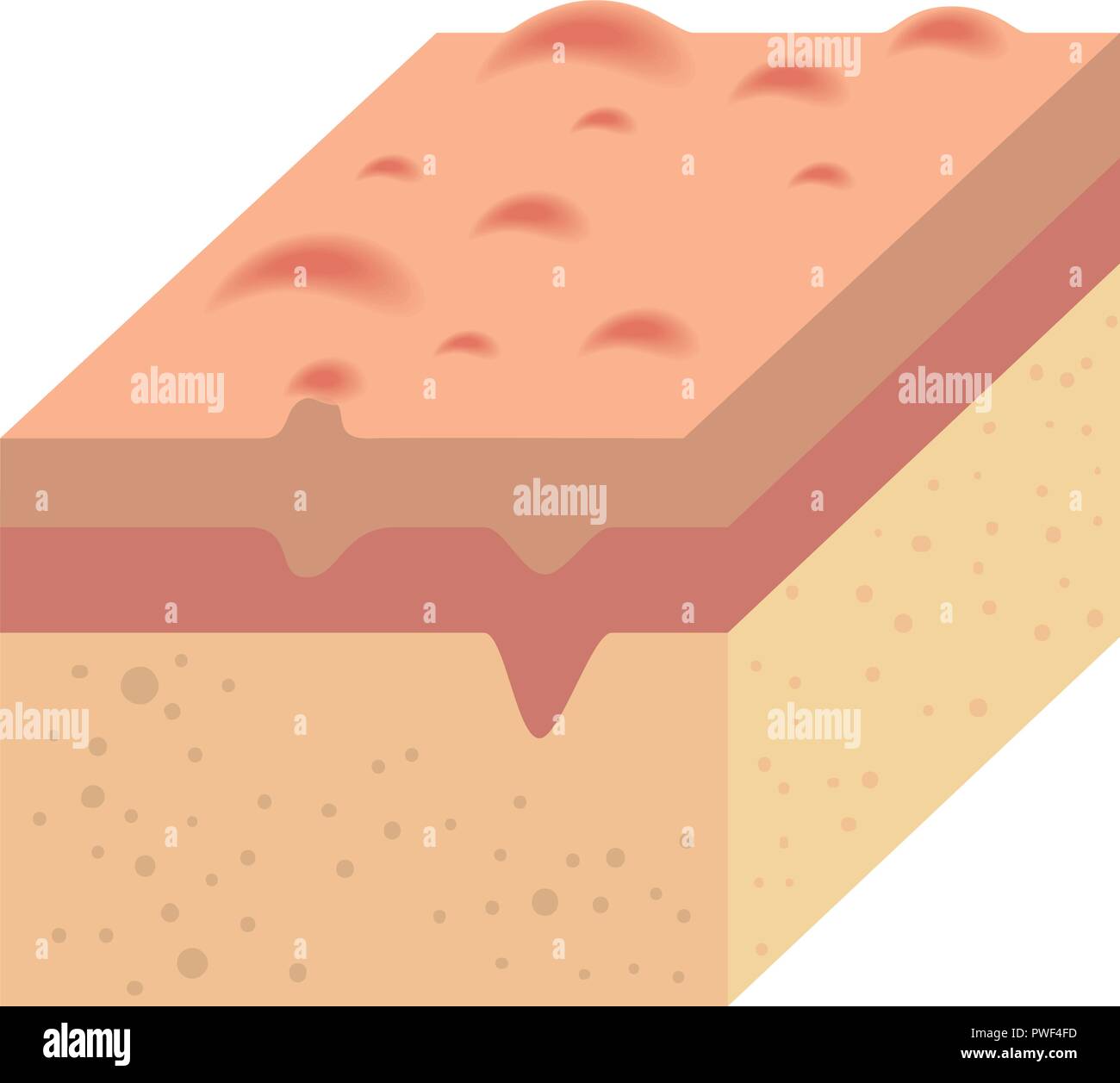 Skin damage diagram Stock Vector Images - Alamy