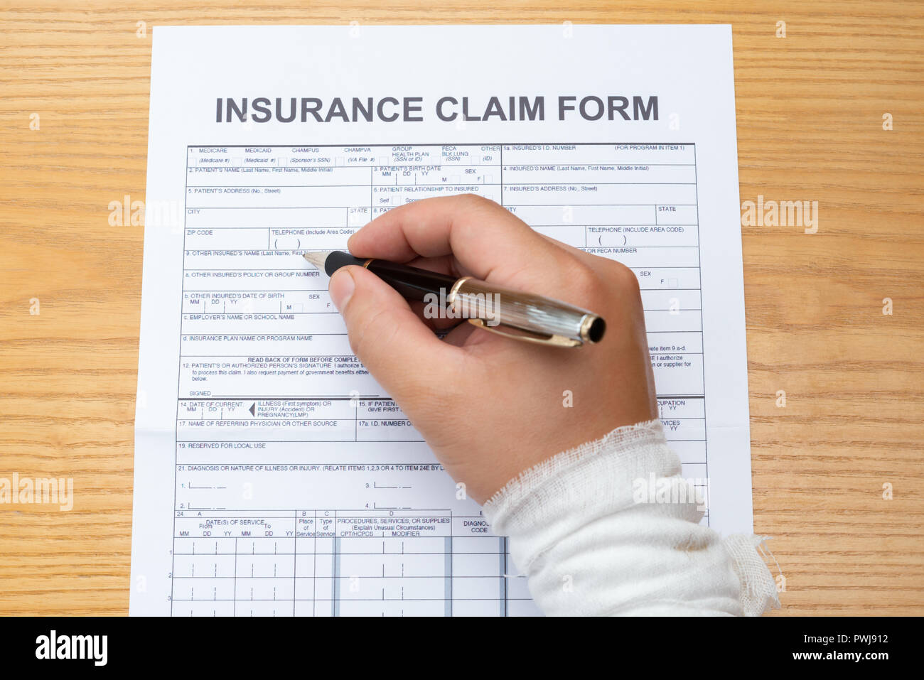 Joint hurted hi-res stock photography and images - Alamy