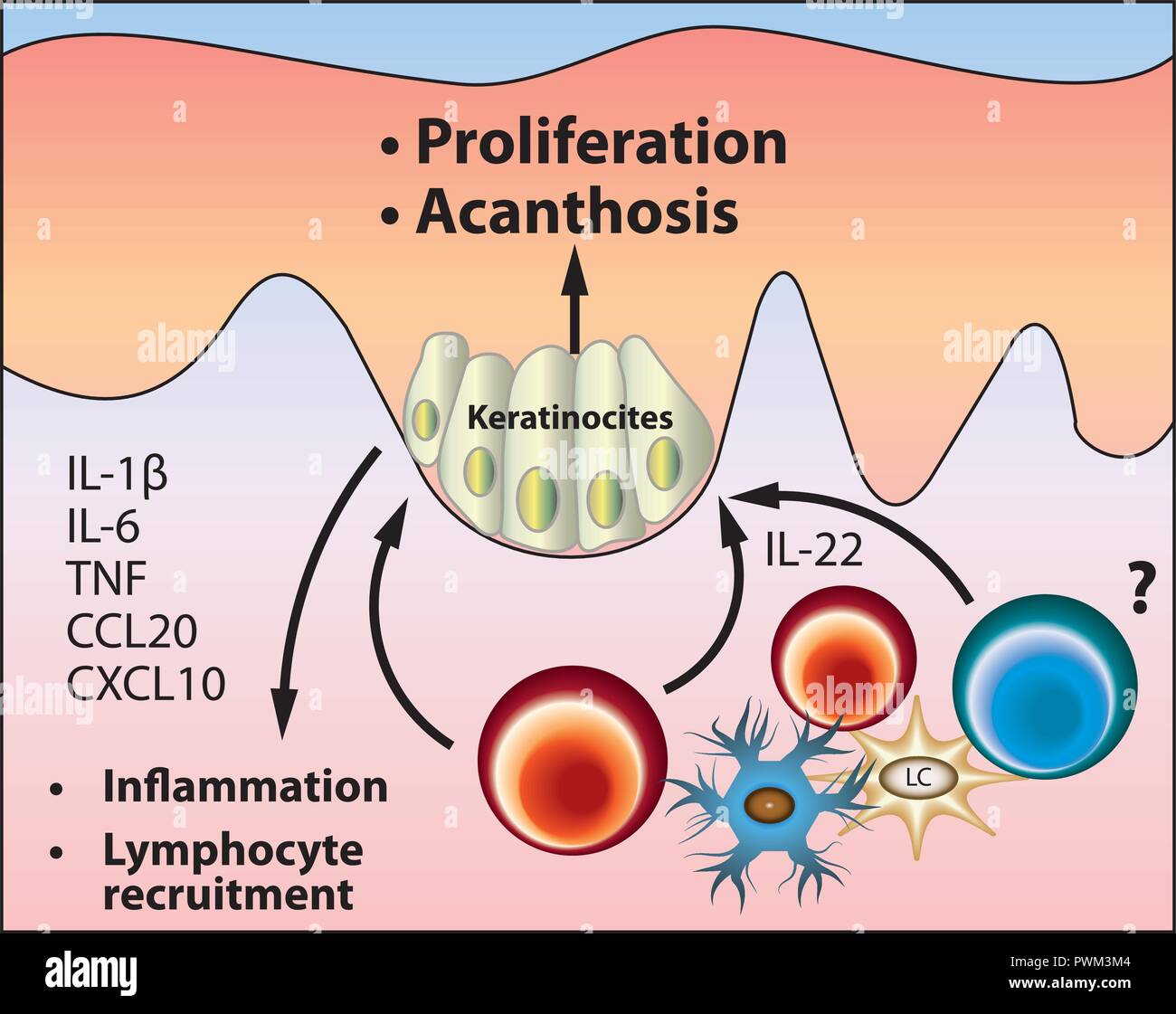 The pathogenesis of acanthosis nigricans scheme, vector medical ...