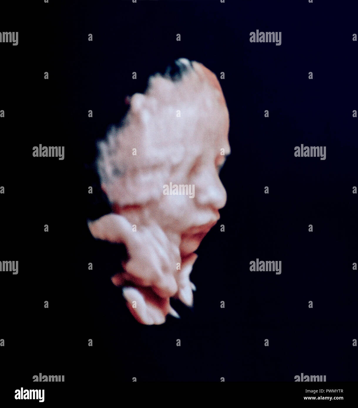 Ultrasound portrait of a fetus inside the womb, with visible pixelation ...