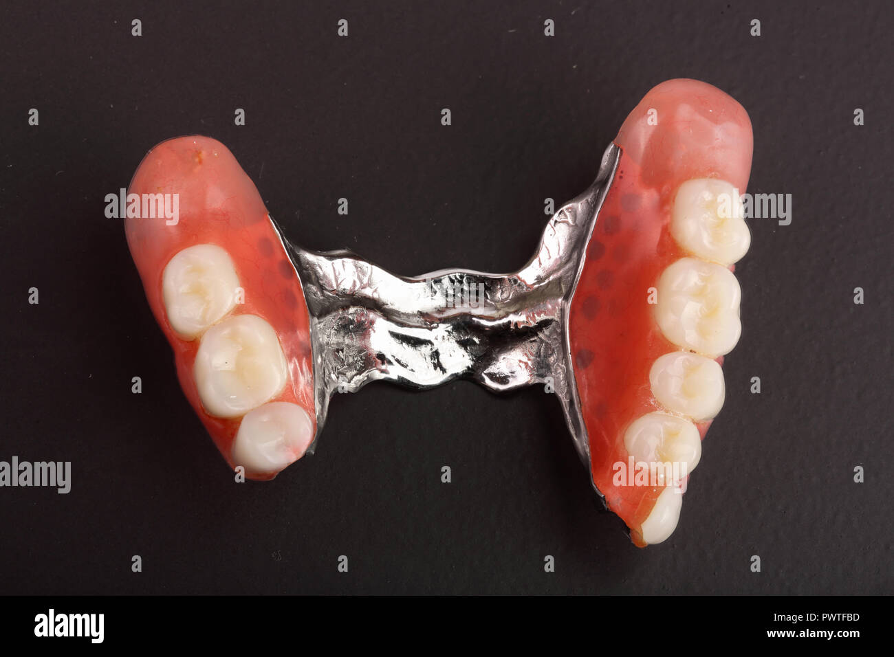 Clasp prosthesis with lock fixation isolated on white background macro ...