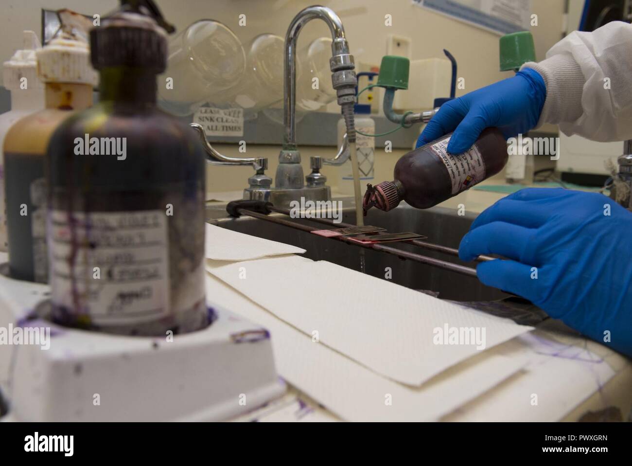 Bacteria gram stain hi-res stock photography and images - Alamy