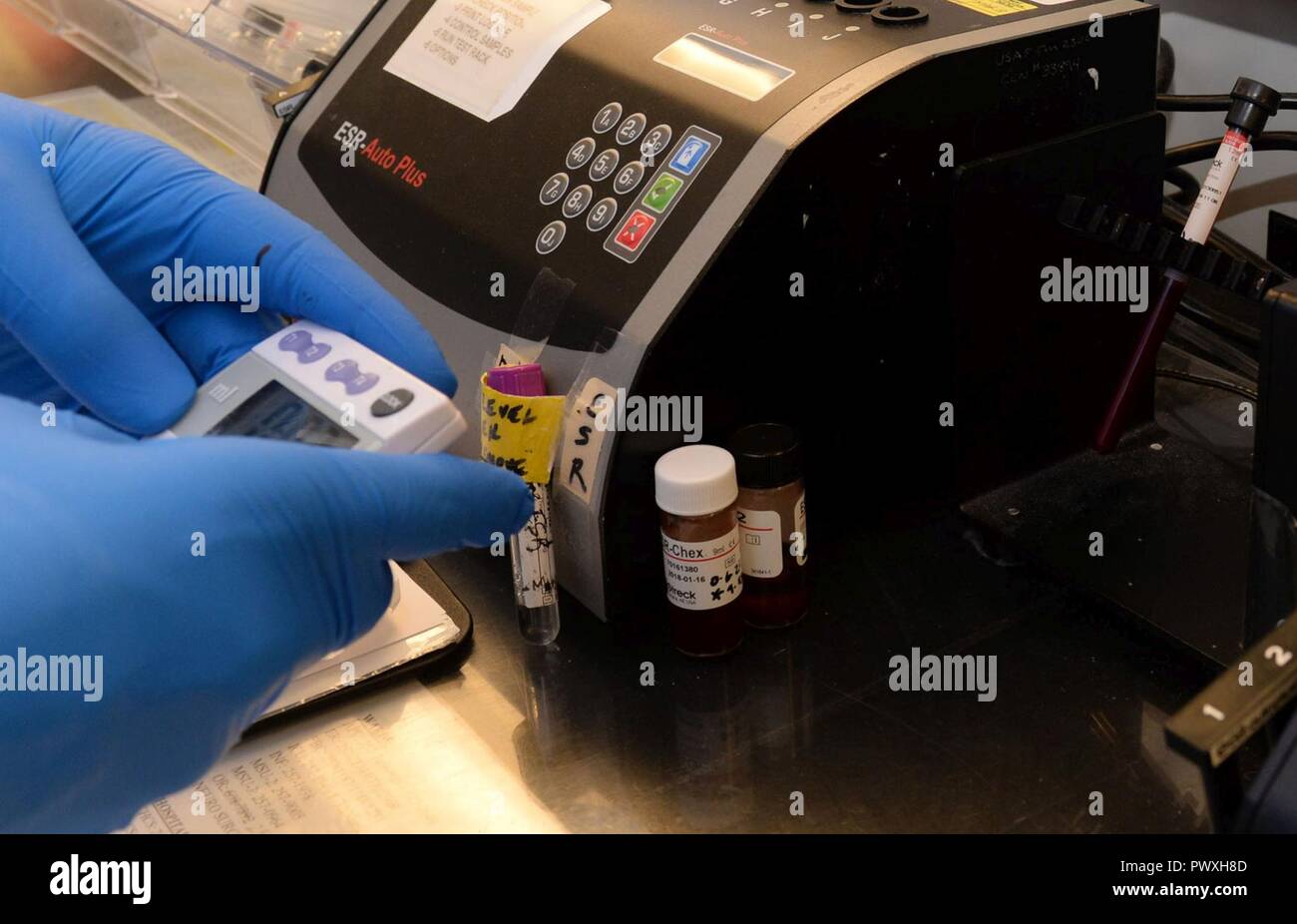 Blood Samples In Blood Collection High Resolution Stock Photography and ...