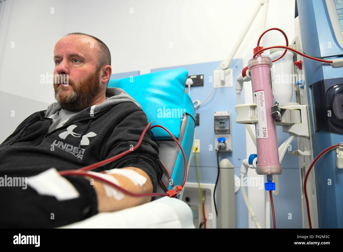 18th October 2018 Pictured is Neil Fabbeni, having dialysis treatment ...
