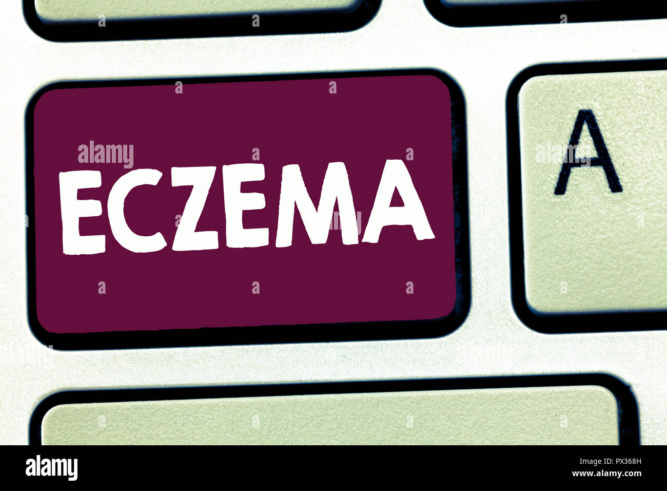 Text sign showing Eczema. Conceptual photo Skin condition marked by ...